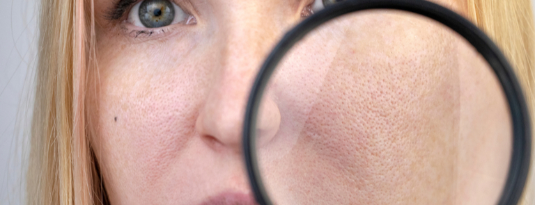 9 Ways To Manage Clogged Pores & Congested Skin | Holland & Barrett