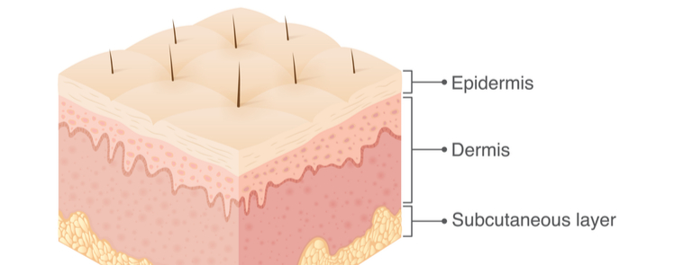 9 Ways To Manage Clogged Pores & Congested Skin | Holland & Barrett