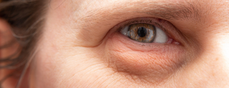 Facial Swelling Guide | Facial Puffiness | Holland & Barrett