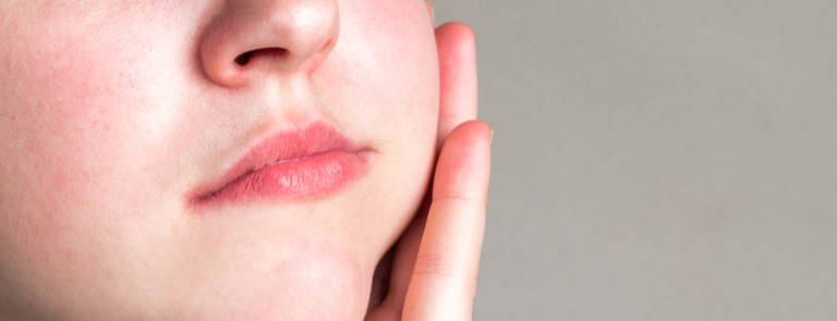 Facial Swelling Guide | Facial Puffiness | Holland & Barrett