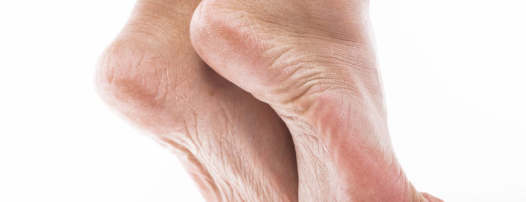 How to get Rid of Hard Skin on Feet | Holland & Barrett