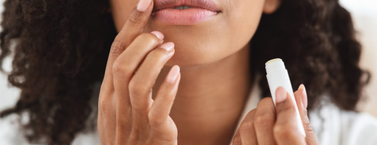Chapped Lips: Causes & Remedies | Holland & Barrett